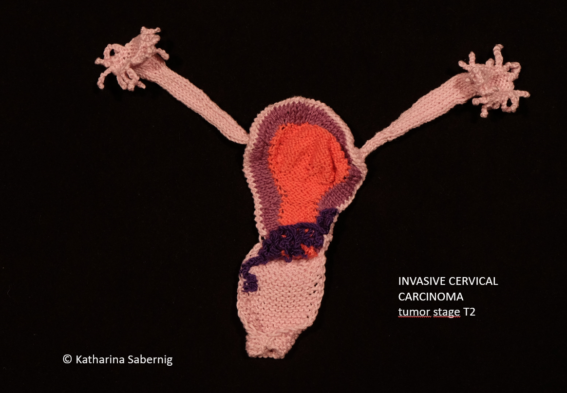 Female Urogenital System Knitted Anatomy