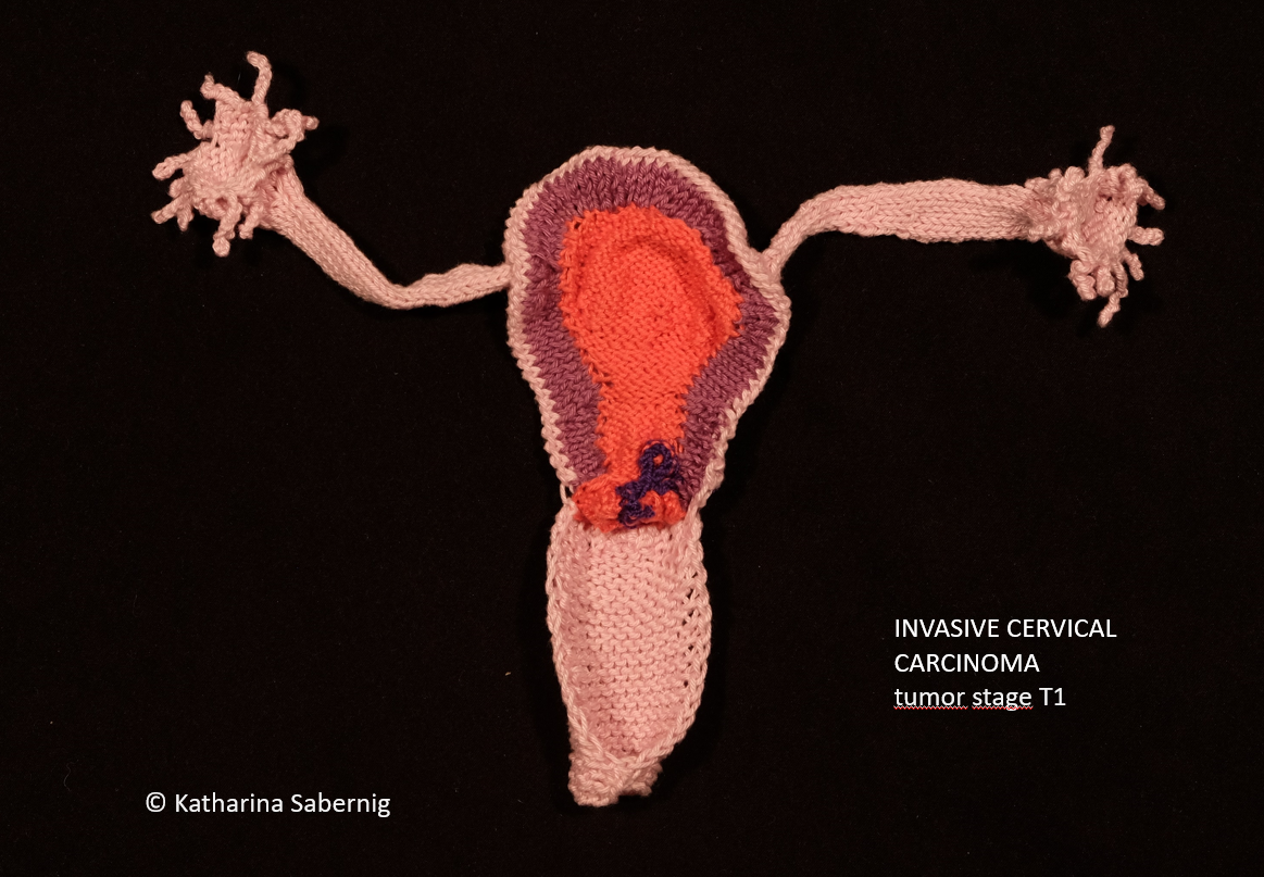 Female Urogenital System Knitted Anatomy